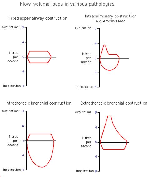 Flow Volume Loops Abnormal Primary Care Notebook