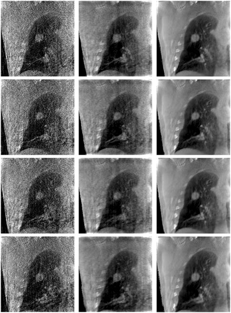 Results Of Patient Data Reconstructed By Using Different Methods The