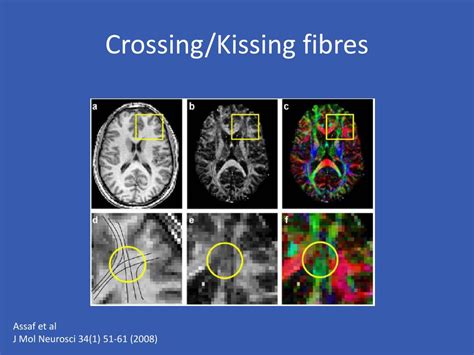 Ppt Diffusion Tensor Imaging Powerpoint Presentation Free Download Id6728456