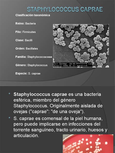 Clasificación Y Estructura De Staphylococcus Caprae Una Bacteria Comensal De La Piel Humana Que