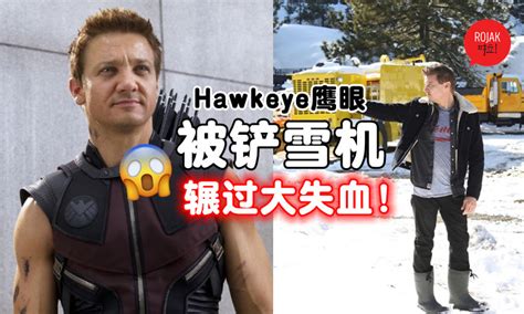 Omg！marvel英雄“鹰眼”遭铲雪机辗过⚡拖行着走！一度大量出血急动2手术救命！