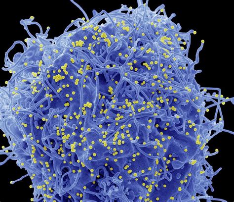 Hiv Infected Cell Photograph By Steve Gschmeissnerscience Photo Library Fine Art America