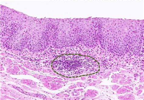 Diffuse Lymphoid Tissue Histology Flashcards Quizlet