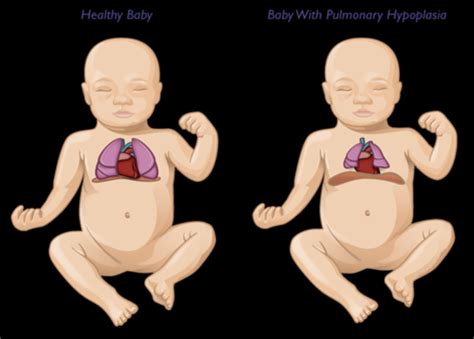 Fetal Lung Development And Function Pb Flashcards Quizlet