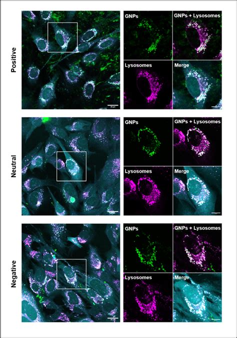 Internalization Of Gelatin Nanoparticles Confocal Live Cell Images Download Scientific Diagram