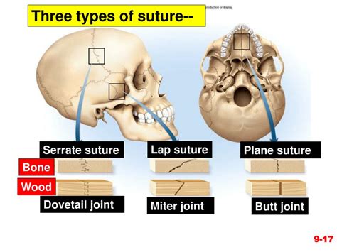 Ppt Chapter 9 Joints Powerpoint Presentation Free Download Id 2172415