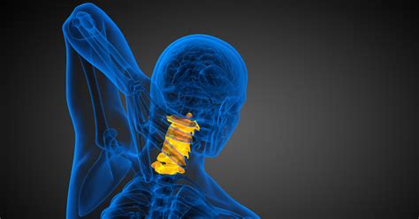Tinnitus And Occipital Neuralgia A Documented Tie