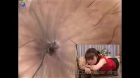 Camera Inside Rectum