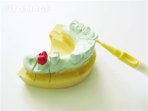 유토이미지 치간칫솔과 구강 모형