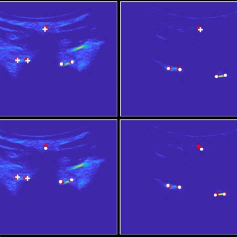 Visual Comparison On Challenging Transverse Slices As Shown In The 1