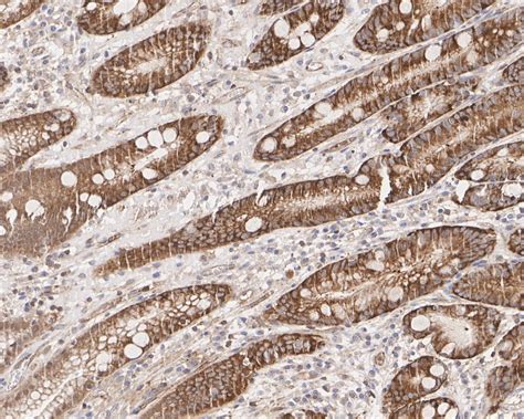 Cofilin Recombinant Rabbit Monoclonal Antibody Psh01 44 Ha721682