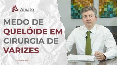 Medo de Quelóide em Cirurgia de Varizes Como Evitar e Tratar