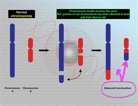 Balanced Translocation And Risk Of Recurrent Miscarriage