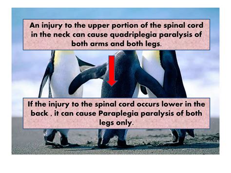Spinal Cord Injury Ppt Pptx
