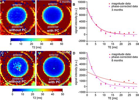 technical improvement of the t2 mapping a phase correction method was