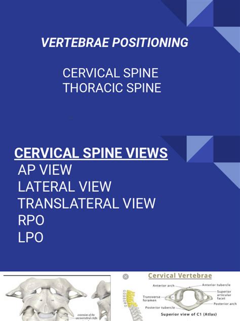 Vertebrae X Ray Positioning Pdf Vertebral Column Anatomical Terms Of Motion