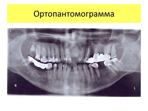 Методы обследования стоматологического больного презентация онлайн