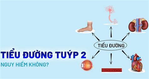 Some Complications Of Type 2 Diabetes Bepharco