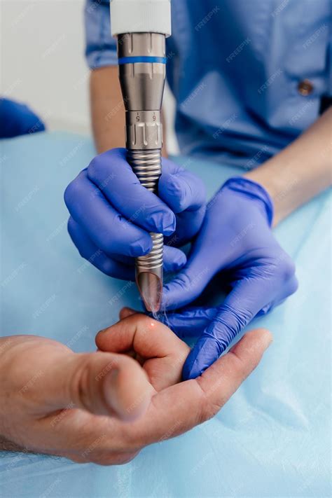 Premium Photo The Doctor Removes Moles And Warts With A Laser Beam