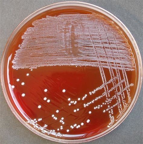 Meningitis