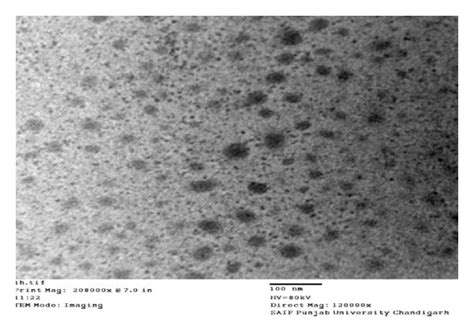 Transmission Electron Micrograph Tem Image Of Optimized Formulation