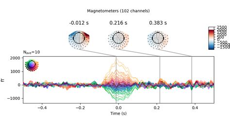Overview Of Artifact Detection — Mne 1 2 2 Documentation