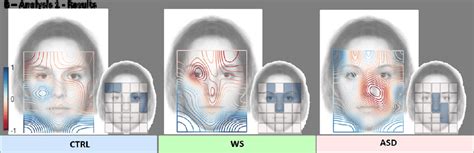 Method And Results Of The Single Trial Evoked Activity Analysis A Download Scientific Diagram