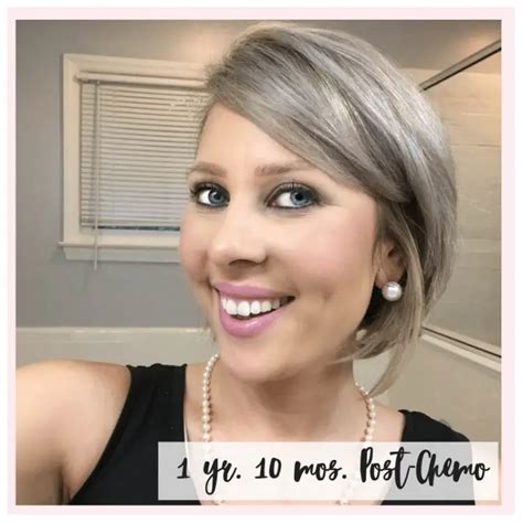 Chemotherapy Hair Loss Timeline