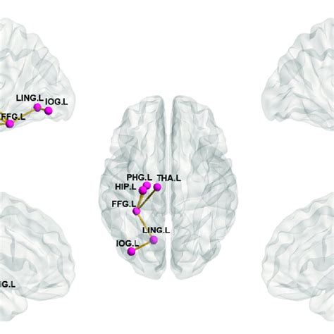 Three Dimensional View Of Brain Hubs With Differences Between Healthy Download Scientific