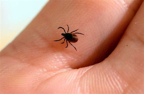 Rise In Lyme Disease Cases Sparks Calls For Specialist Clinics To