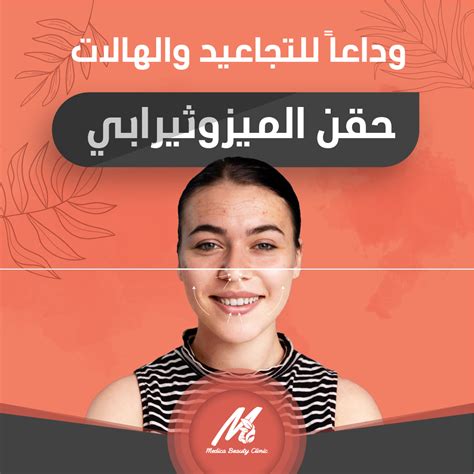 خطة تسويقية لمركز ميديكا للتجميل والعناية بالبشرة التسويق الإلكتروني
