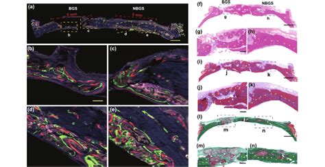 Fluorescent Imaging And Histological Staining Of The Cranial Bone