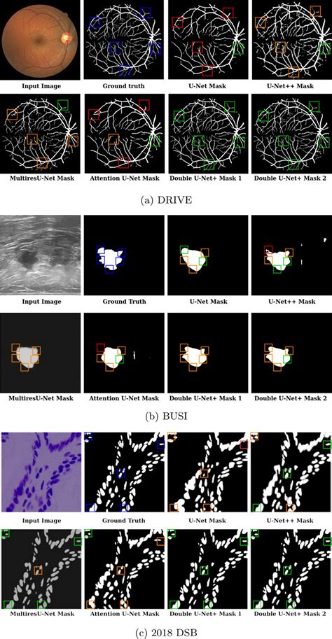 Visual Comparative Analysis Among Different Segmentation Methods First