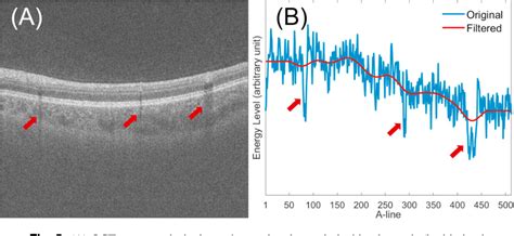 Figure 5 From Deep Learning Based Noise Reduction Method For Automatic