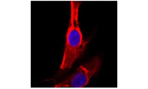 Fibroblast Cell Markers Bio Techne