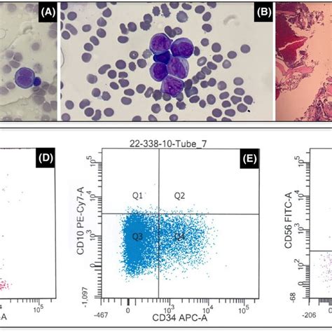 Molecular Genetic Analyses By Pcr Showing Pml‐rarα And Flt3‐itd