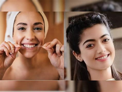 Dental Care Tips For Healthy And White Teeth Get Rid Of Yellow Teeth Problem Teeth Cleaning