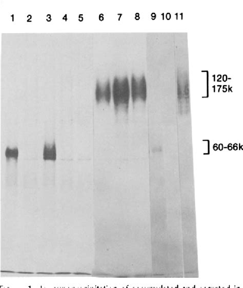 Figure 1 From Yeast Secretory Mutants That Block The Formation Of