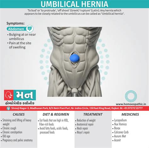 Umbilical Hernia Mann Homeopathy Clinic Rajkot