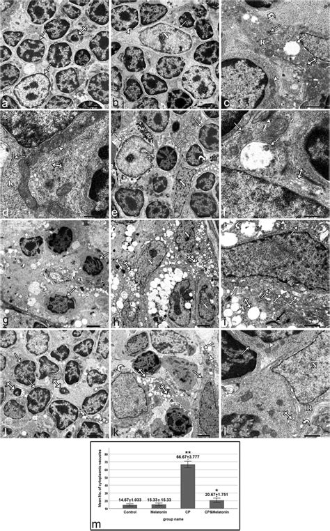 Electron Micrograph Of Thymic Cortex A D Control Sections A The Download Scientific