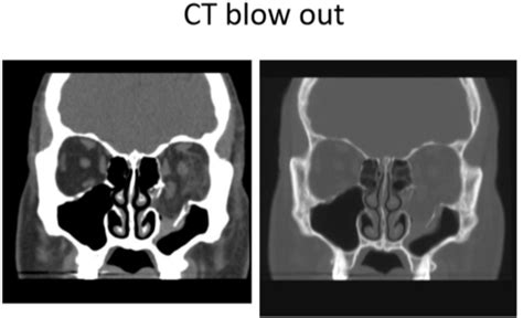 18 Alternative Imaging Modalities Flashcards Quizlet