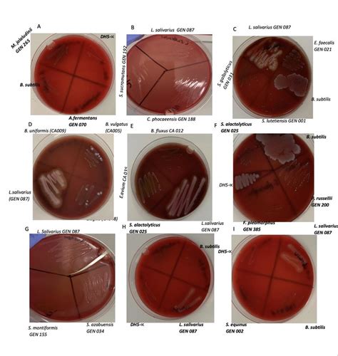 Hemolysis Screening Of Isolated Species Download Scientific Diagram