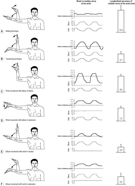 Neurodynamics Movement For Neuropathic Pain States Musculoskeletal Key
