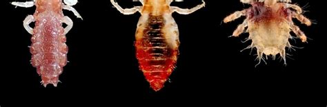 Distinguishing Between Crab Body And Head Lice Uc Agriculture And
