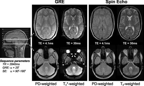 Gradient Echo Imaging Markl 2012 Journal Of Magnetic Resonance