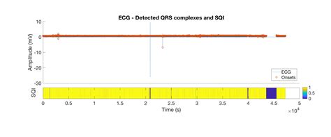Issue When Having Missing Data · Issue 10 · Cliffordlabphysionet