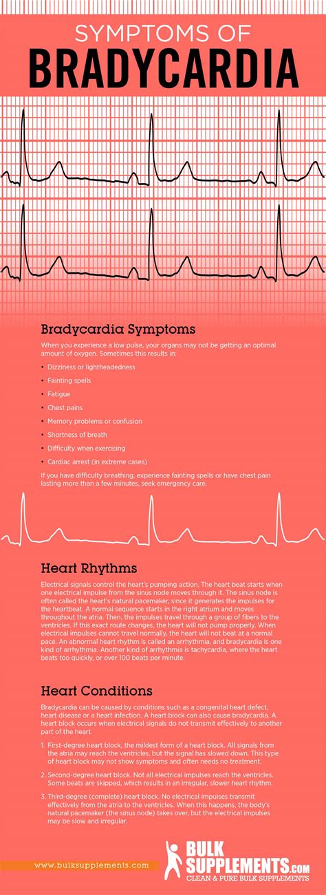 Tablo Read Bradycardia Symptoms Causes And Treatment By