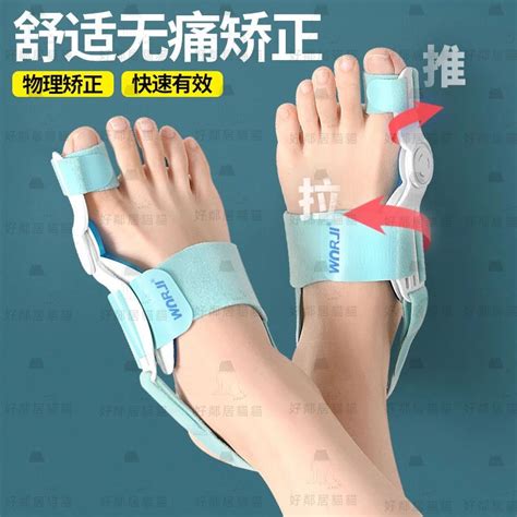 二代拇指外翻腳趾矯正器分大母腳趾頭足糾正大腳骨可以穿鞋男女士拇指外翻 大拇指套 腳骨突出矯正帶 腳趾套 腳趾固定帶 腳趾 蝦皮購物