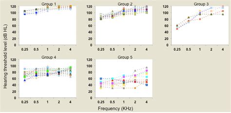 individual audiometric curves db hl according to frequency khz for