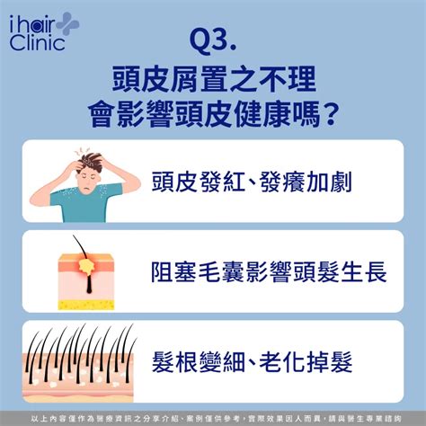 頭皮屑會禿頭嗎養髮專家3qa為你解析 Ihair風華御髮